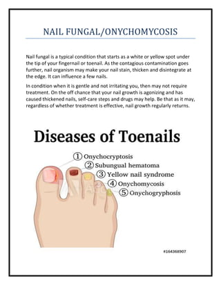 NAIL FUNGAL/ONYCHOMYCOSIS - Dr. Naval's Clinic | PDF