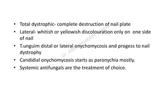 Nail Changes in Common skin diseases | PPTX