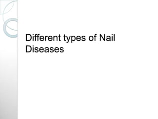 Nail issues | PPTX