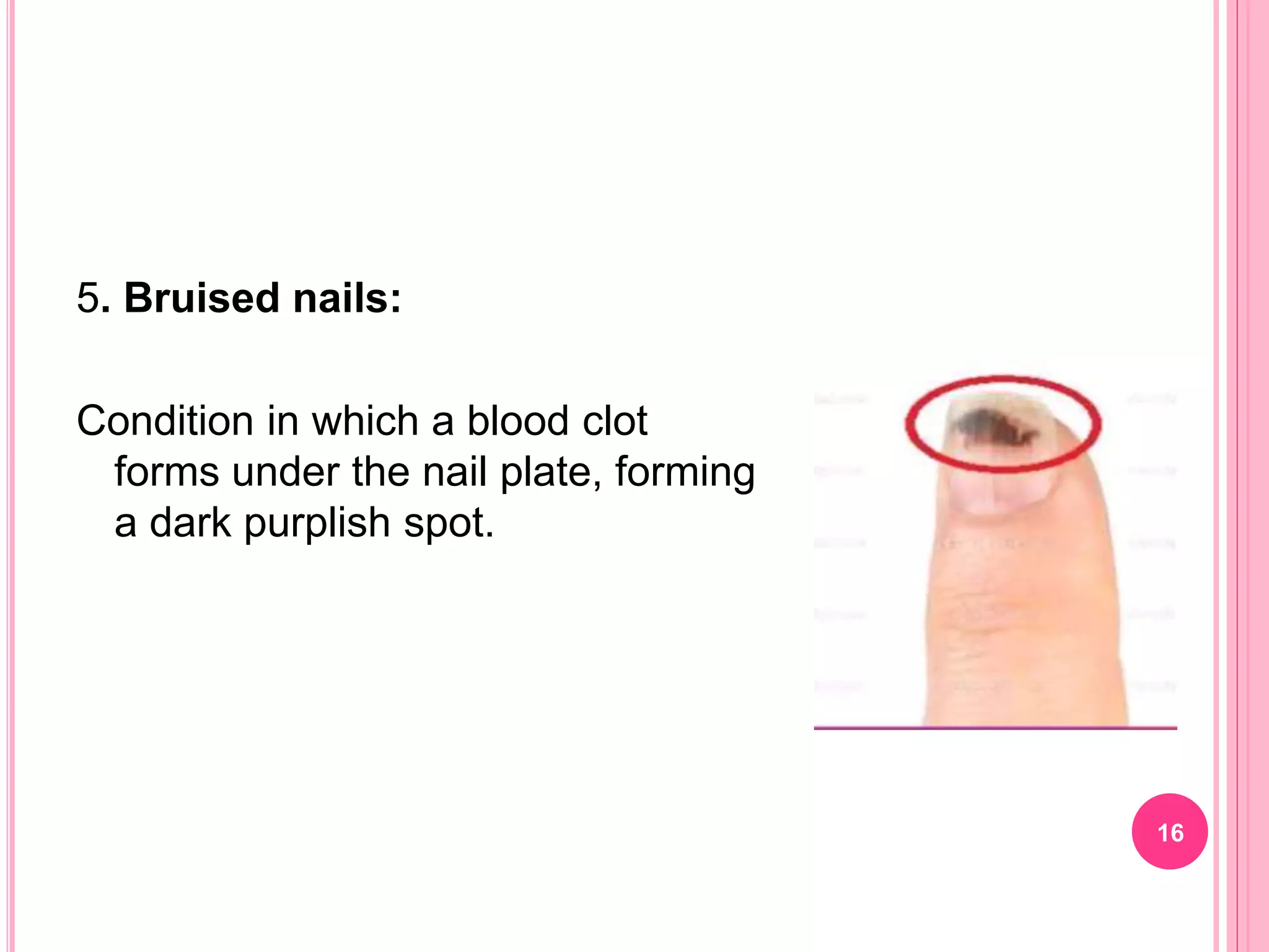 Diseases of nail and their treatment | PPTX