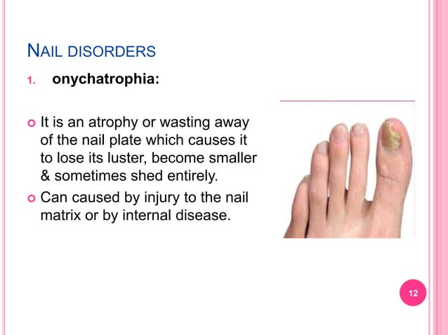 Diseases of nail and their treatment | PPTX | Nail Care | Beauty