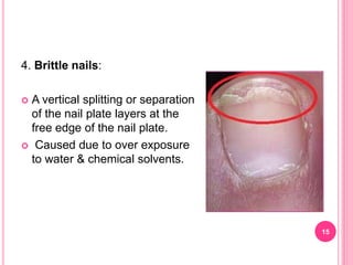 Diseases of nail and their treatment | PPTX