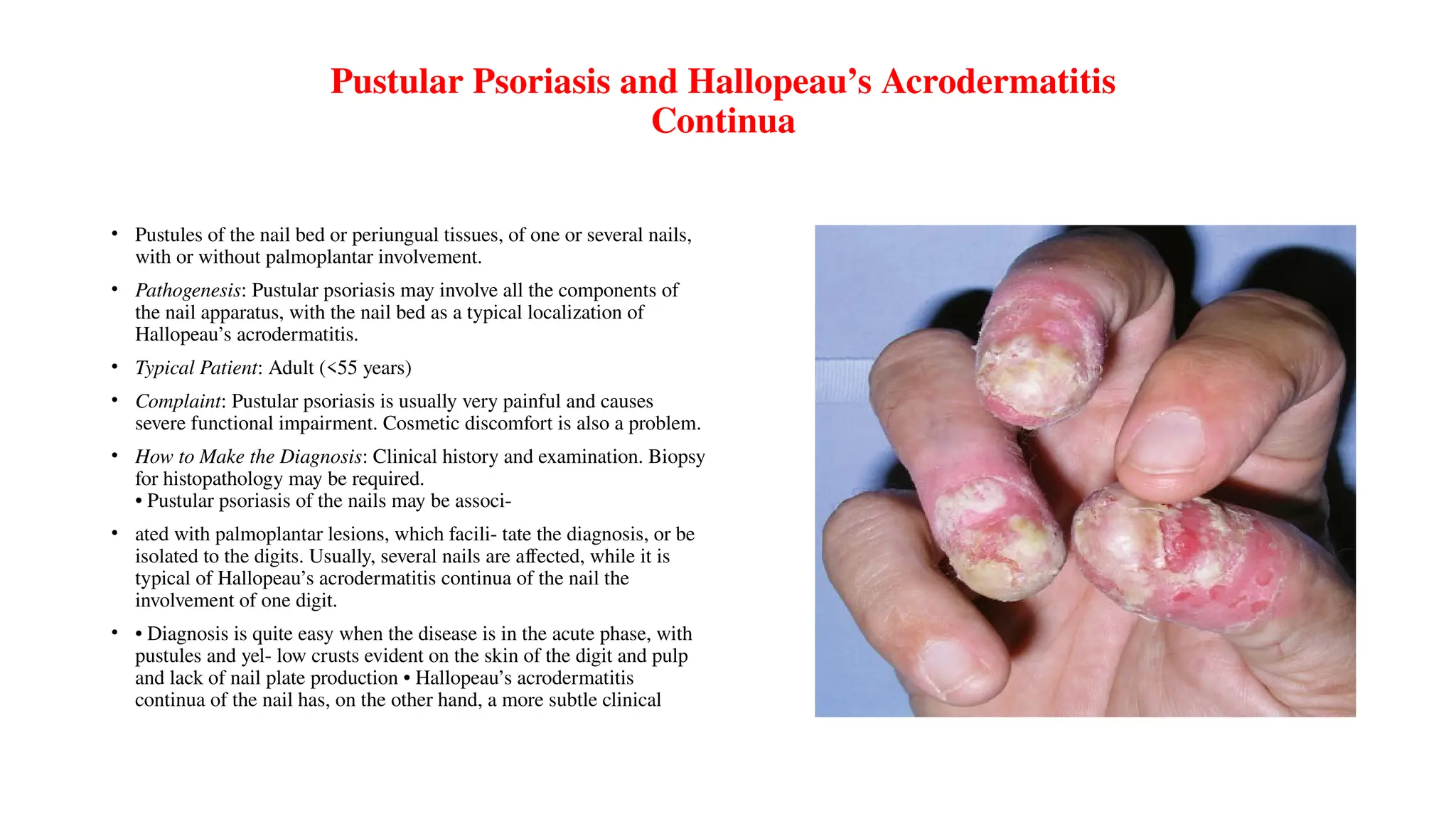 nail psoriasis is one of the manifestations of psoriasis | PPTX
