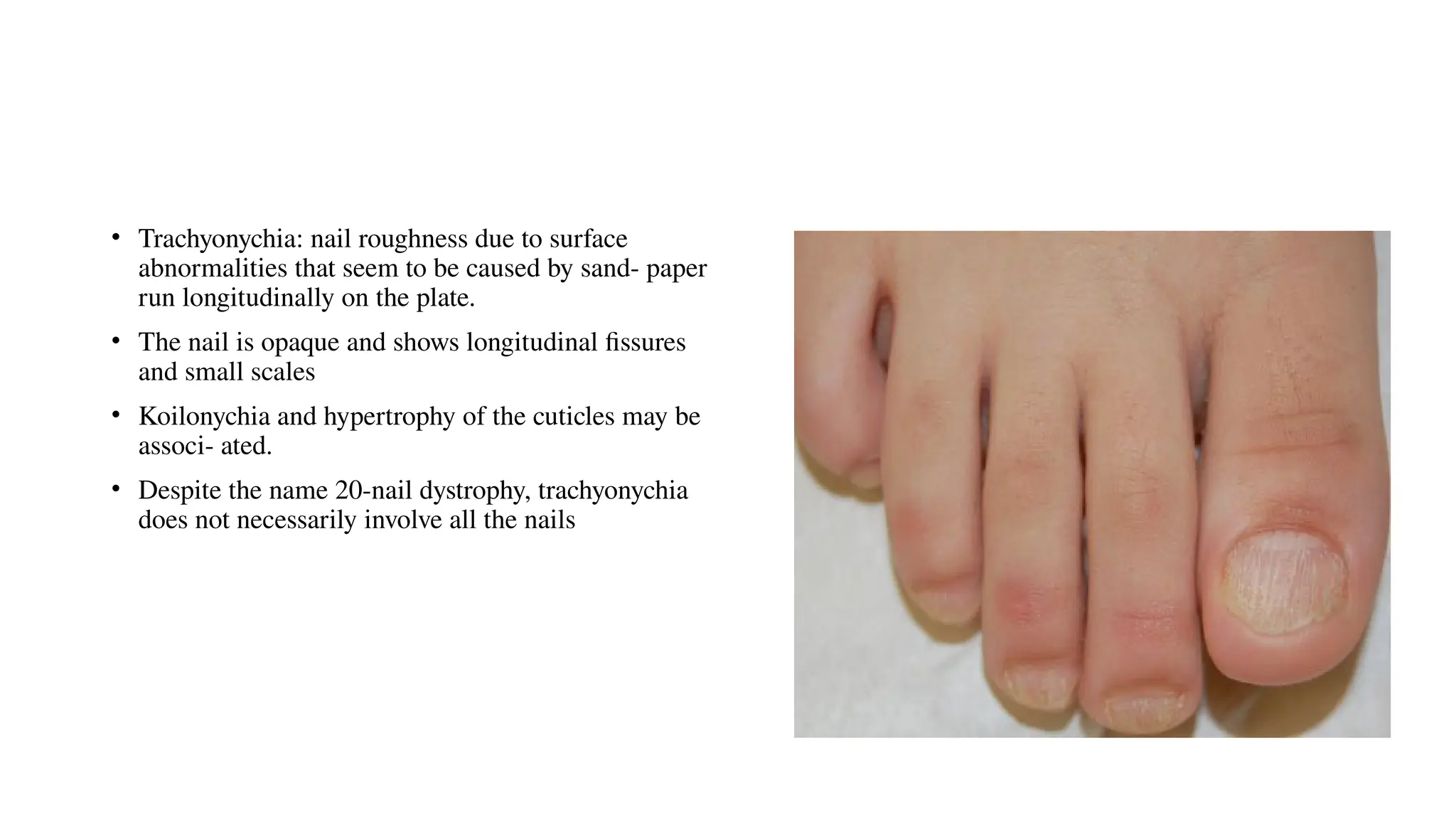 nail psoriasis is one of the manifestations of psoriasis | PPTX