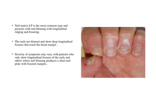 nail psoriasis is one of the manifestations of psoriasis | PPTX