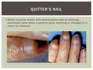 Nails | PPT