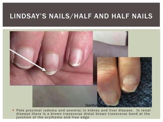 Nails | PPT