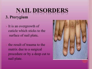 nails-140612090300-phpapp02.pptx
