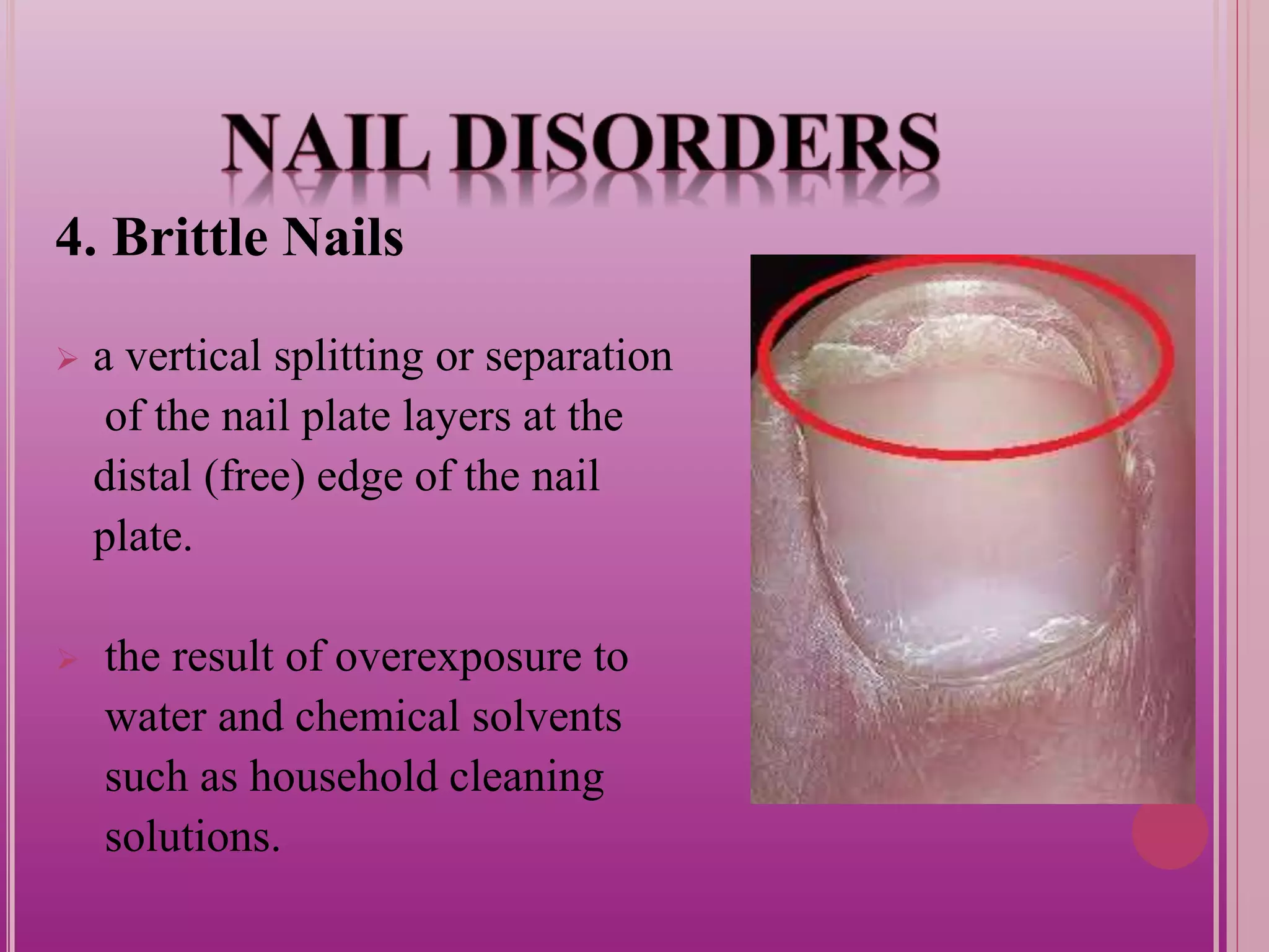 Nails | PPTX
