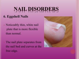 Nails | PPT | Free Download
