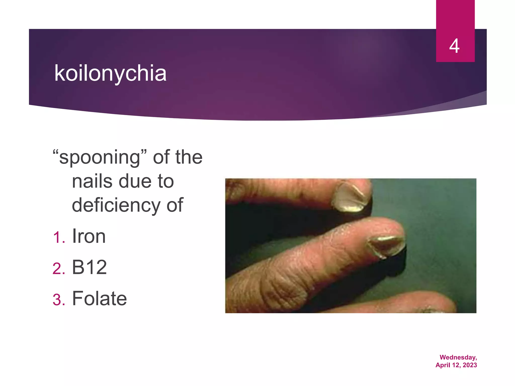 Nails in systemic diseases.ppt