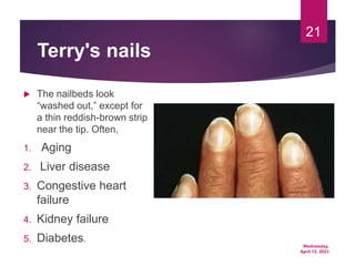 Nails in systemic diseases.ppt