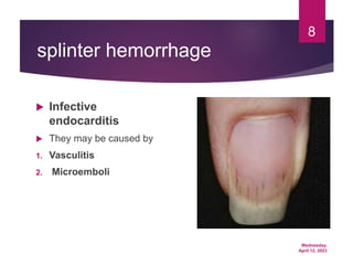 Nails in systemic diseases.ppt