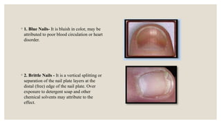 Nail Structures and Shapes.pptx gRADE7 T | PPTX