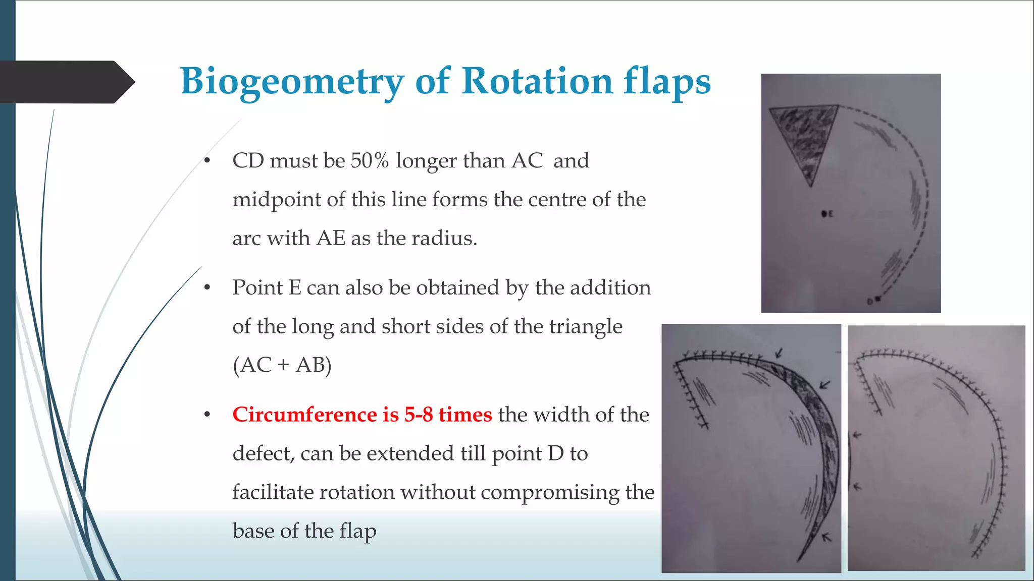 Biogeometry of flaps.ppt