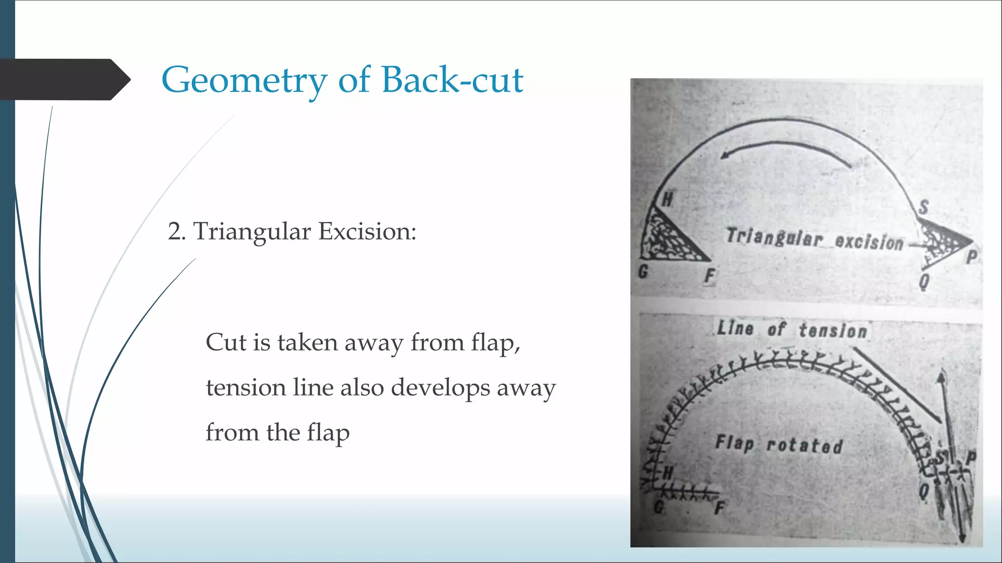 Biogeometry of flaps.ppt