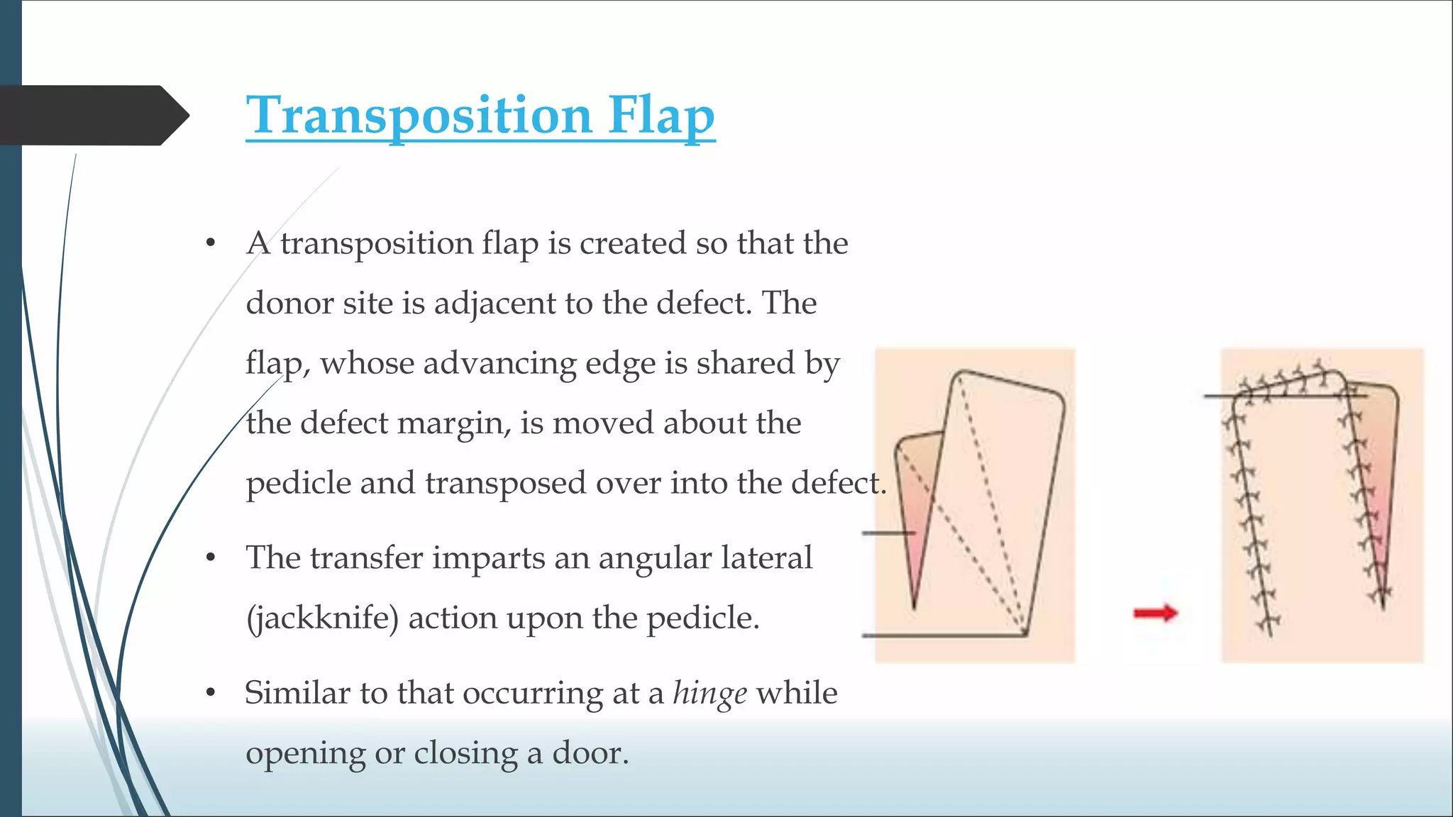 Biogeometry of flaps.ppt