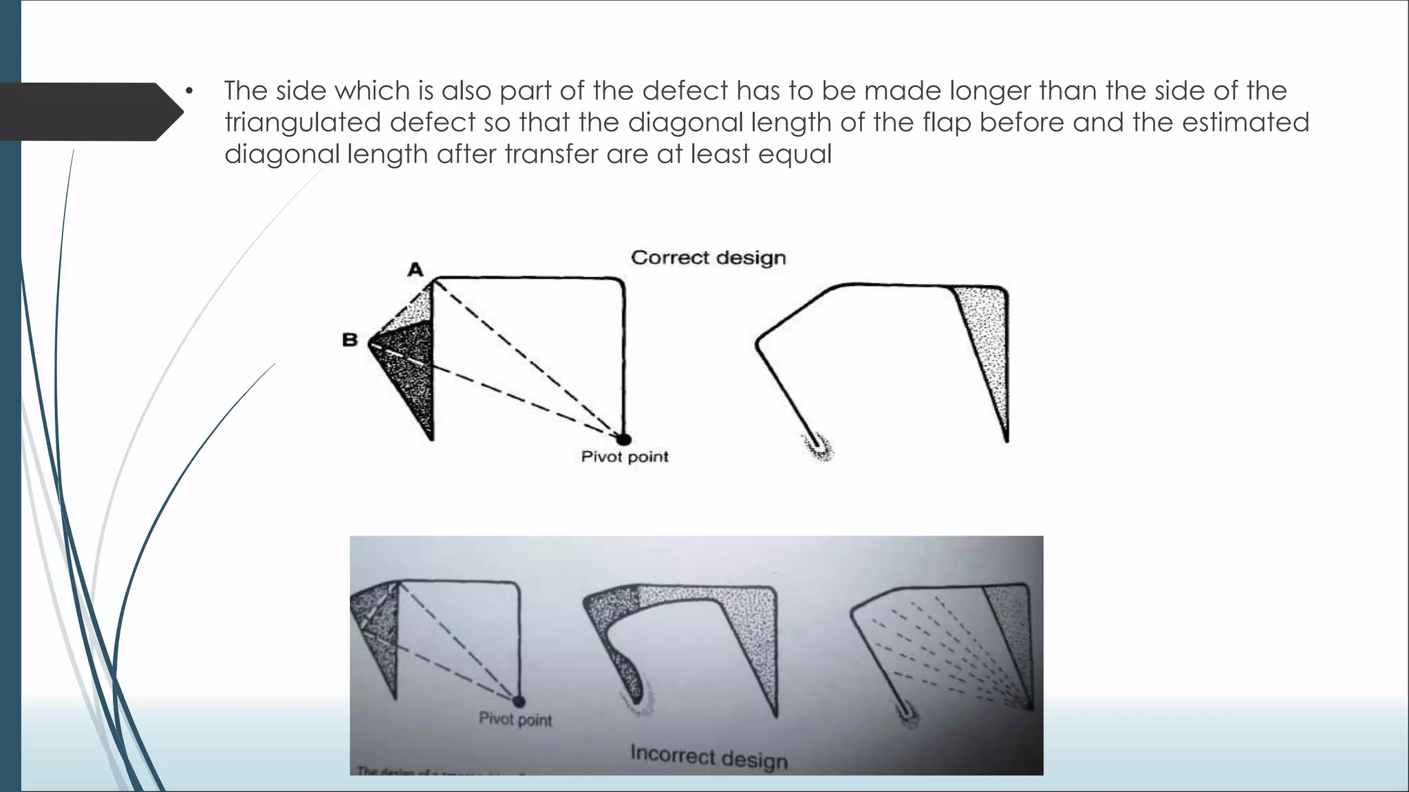 Biogeometry of flaps.ppt