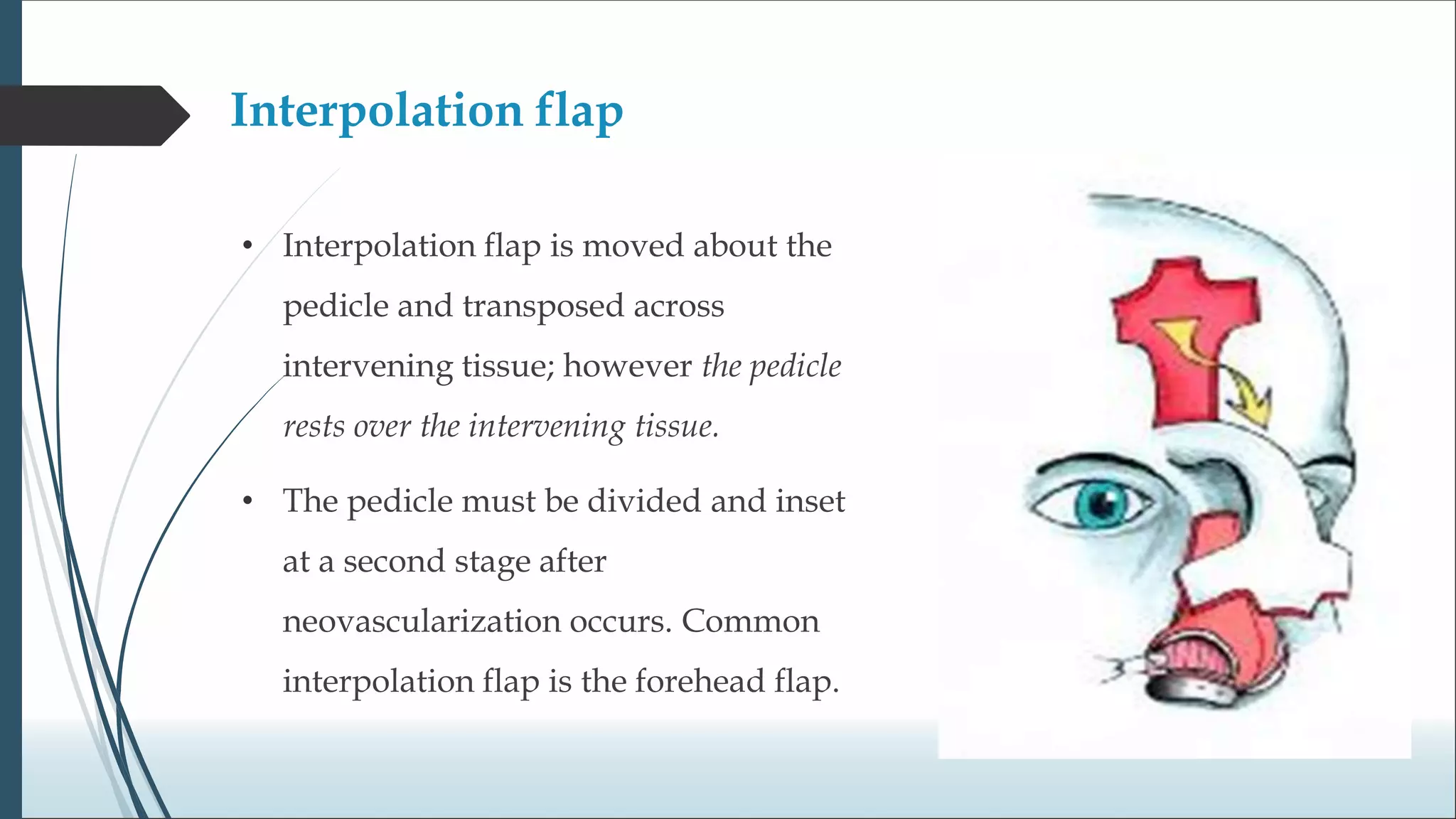 Biogeometry of flaps.ppt