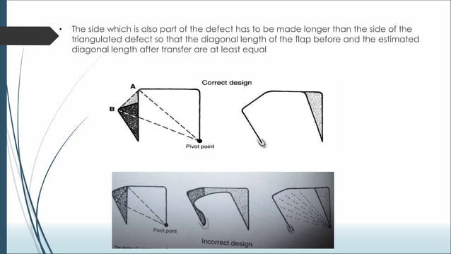 Biogeometry of flaps.ppt