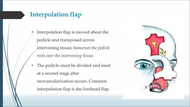 Biogeometry of flaps.ppt