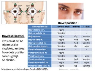 Nakkesmerter og øjenfejl | PPTX