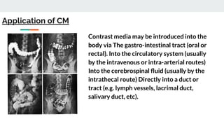 TITLE -Radiopaque contrast media/PHARMACEUTICAL CHEMISTRY | PDF