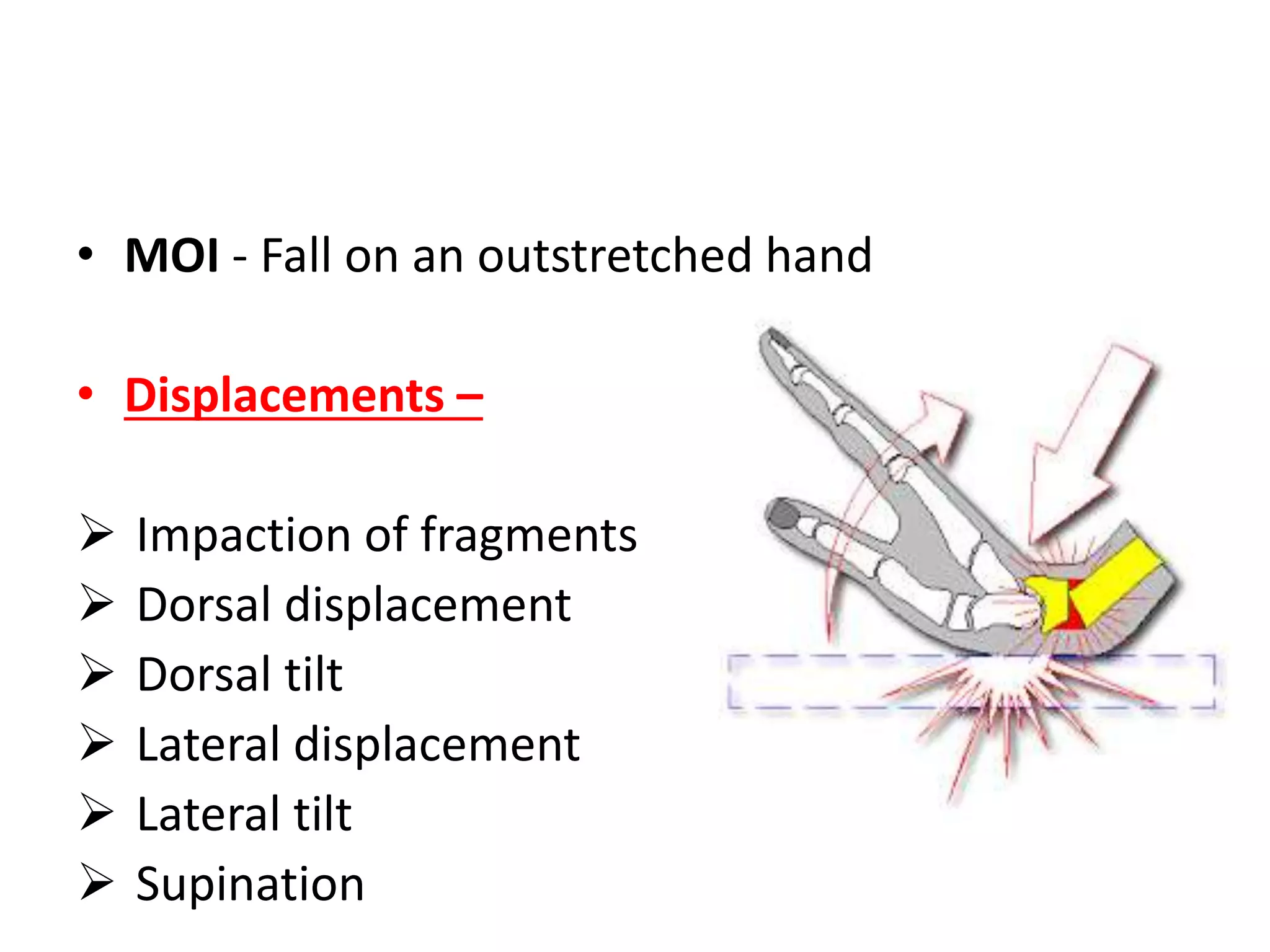Named fractures of forearm ,wrist &and hand | PPTX