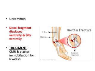 Named fractures of forearm ,wrist &and hand | PPTX