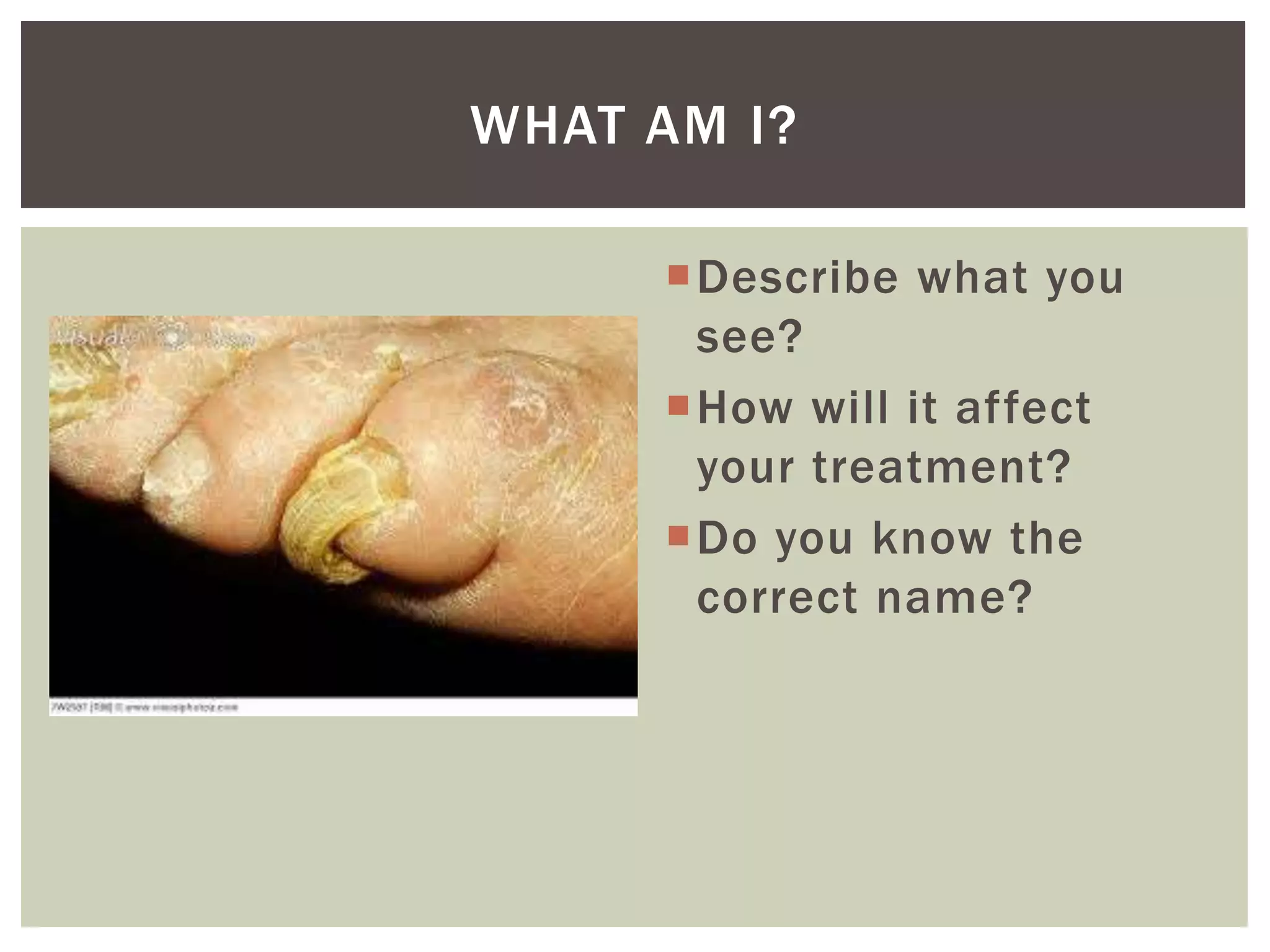 Name that contra indication to manicure | PPTX