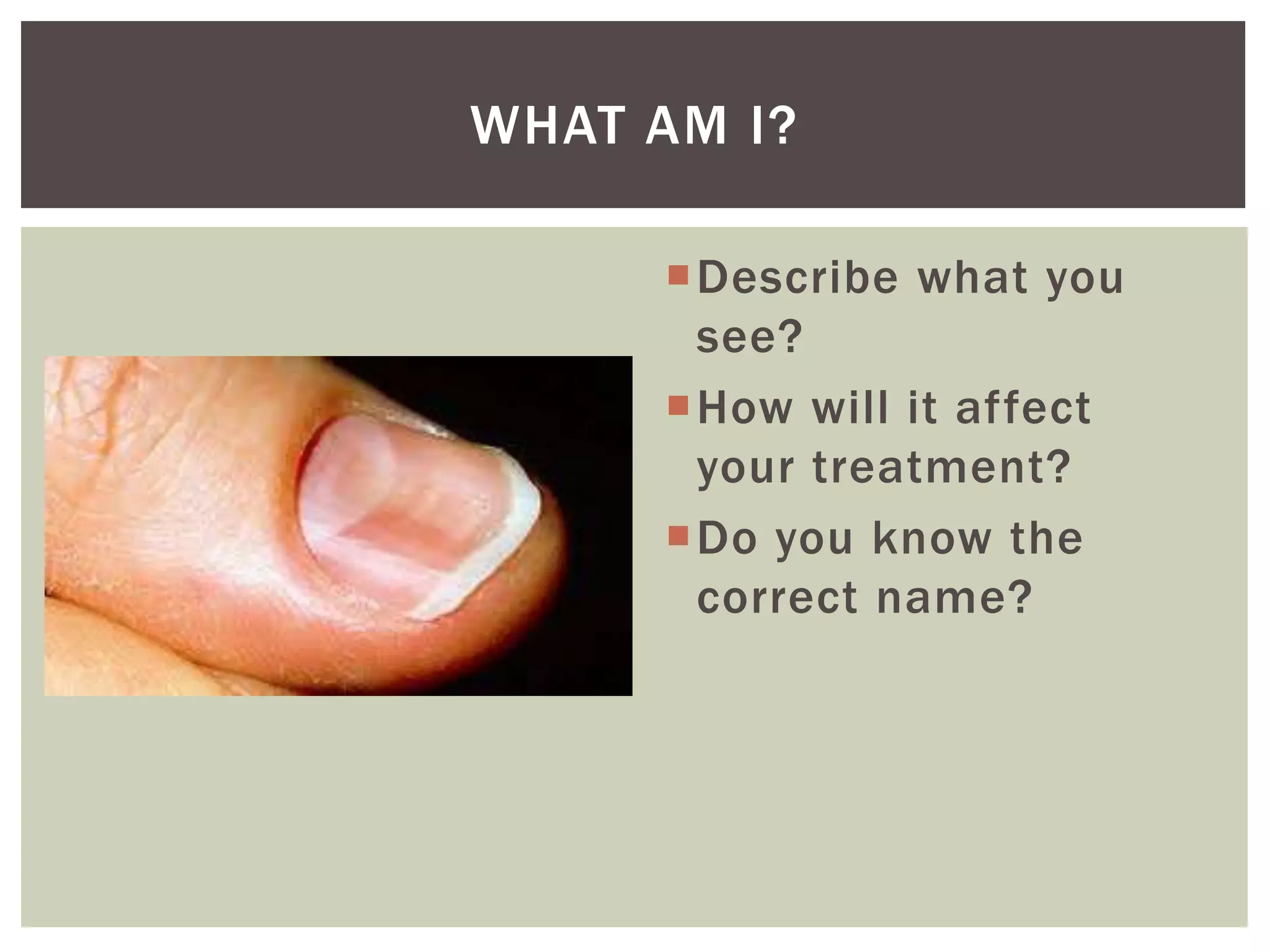 Name that contra indication to manicure | PPTX