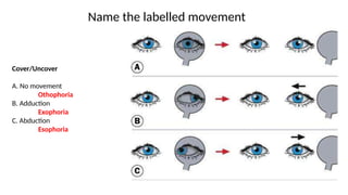 Name the labelled movement - Cover:Uncover test.pptx