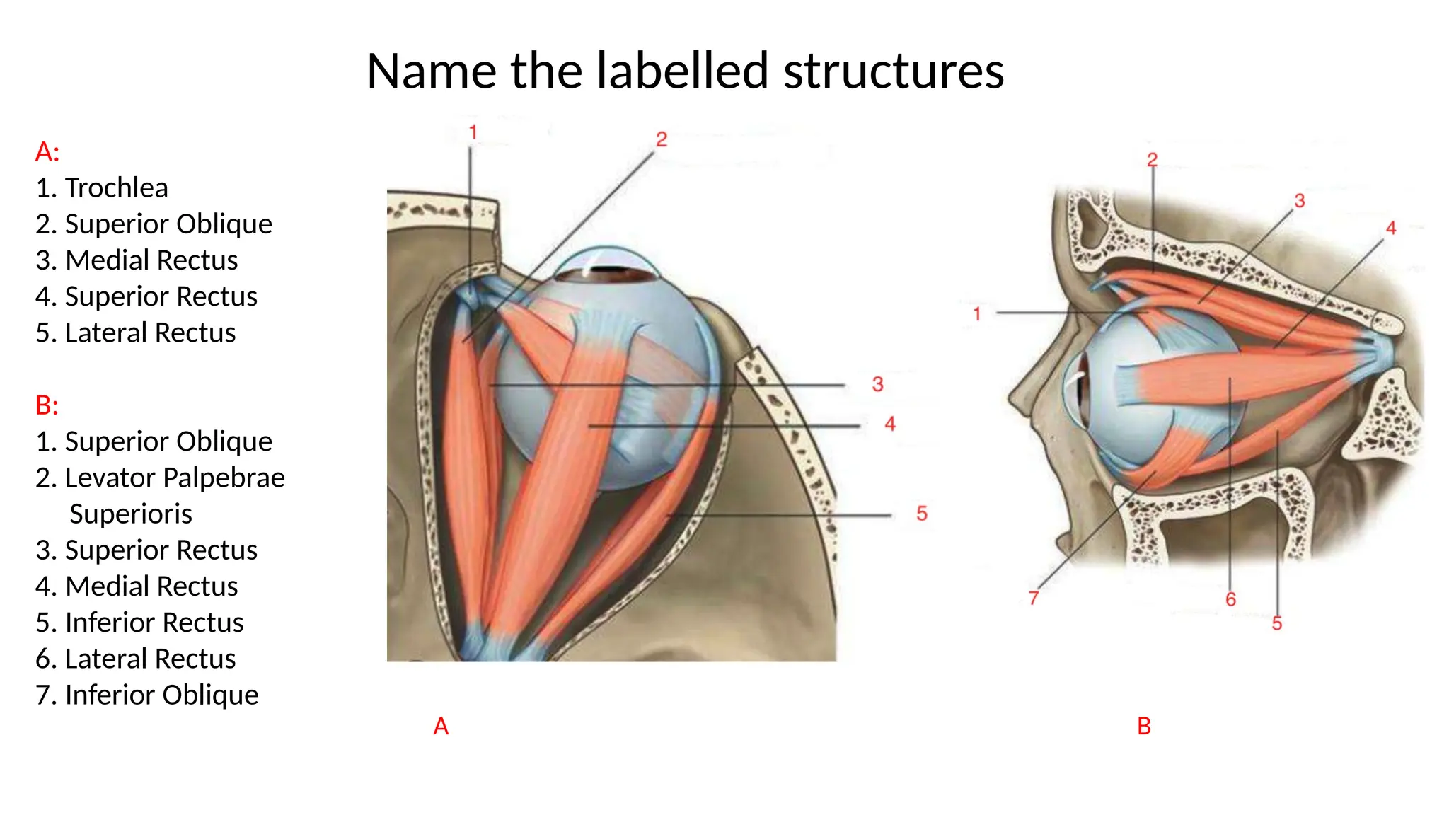 Name the labelled structures - Anatomy of muscles of eyeball.pptx