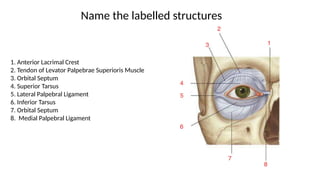 Name the labelled structures - Anatomy of the Eye Lid - Anterior View.pptx