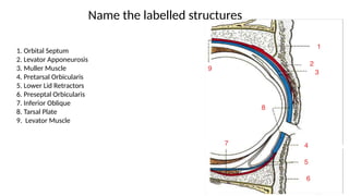 Name the labelled structures - Anatomy of the Eye Lid - Cross Section.pptx