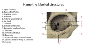 Name the labelled structures - Anatomy of the Orbit.pptx
