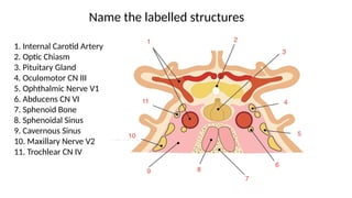 Name the labelled structures - Cavernous Sinus.pptx