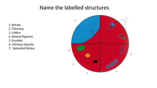 Name the labelled structures - Color Coding for retinal illustration.pptx
