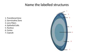 Name the labelled structures - Layers of the Lens.pptx