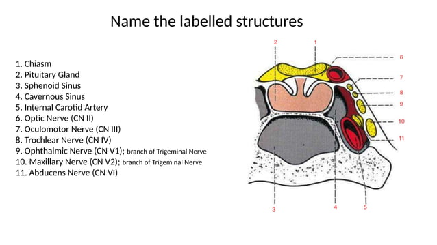 Name the labelled structures - Location of the Cranial Nerves in the ...