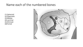 Name the labelled structures - numbered Orbital bones.pptx