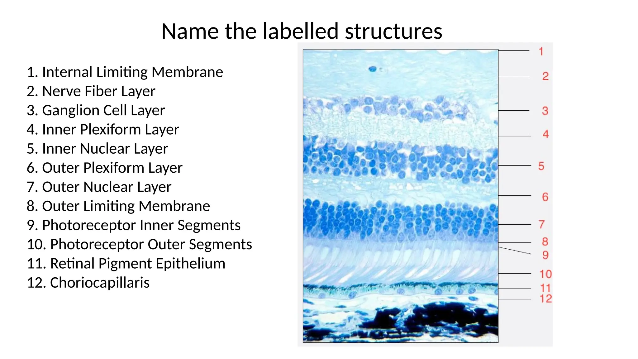 Name the labelled structures - the Retinal Layers.pptx