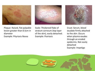 naming-skin-lesion for cvt and for cdu Hyderabad Telangana for india | PPT