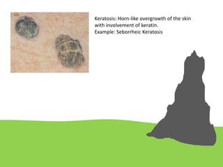 naming-skin-lesion for cvt and for cdu Hyderabad Telangana for india | PPT