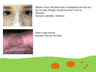 naming-skin-lesion for cvt and for cdu Hyderabad Telangana for india | PPT