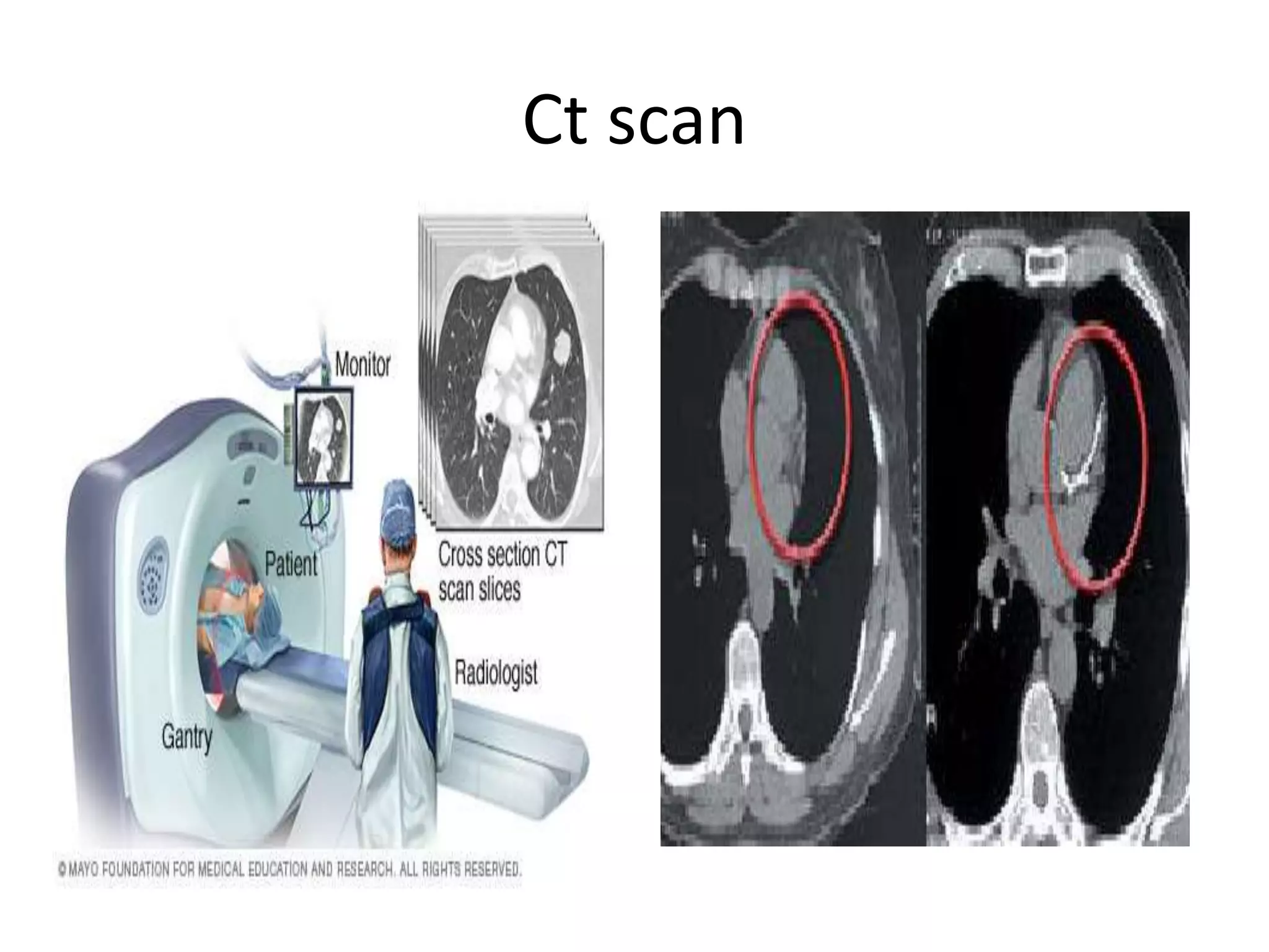 Cardiac Function Test | PPTX