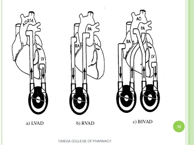 The artificially prepared heart