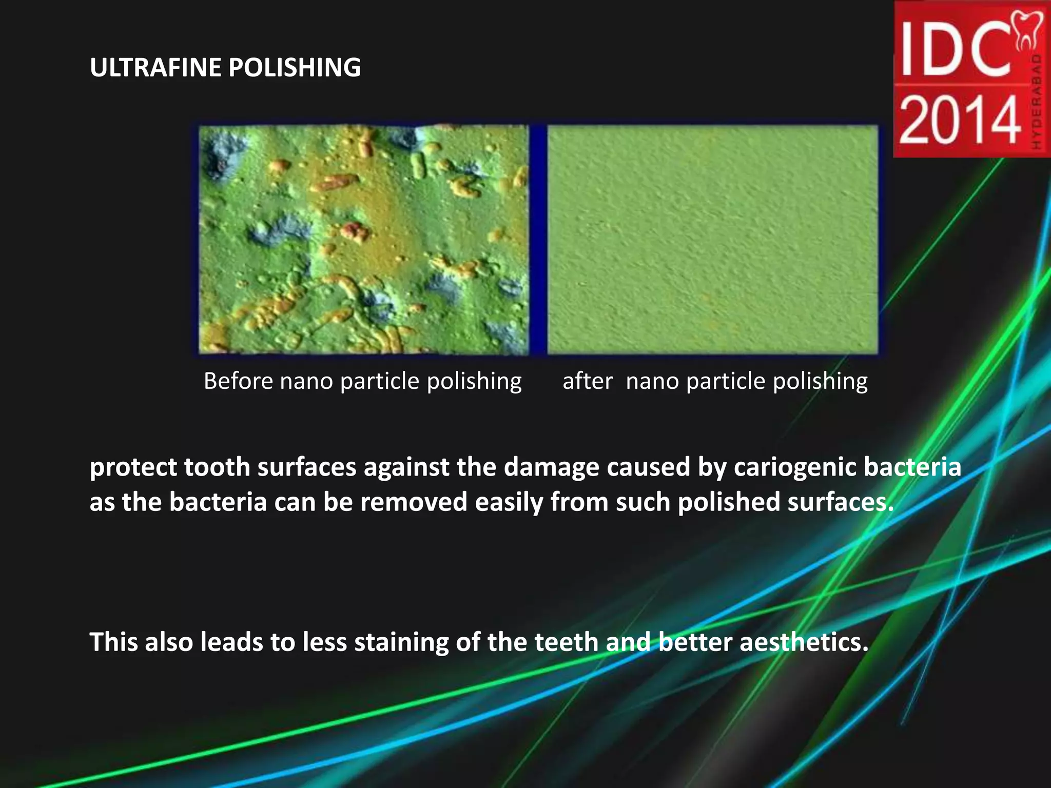 Nano technology in restorative dentistry | PPTX