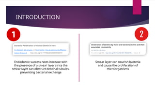 New Technique for Smear Layer Removal in Endodontics | PPTX