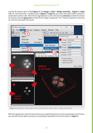 3D object detection and segmentation inside an RI map | PDF